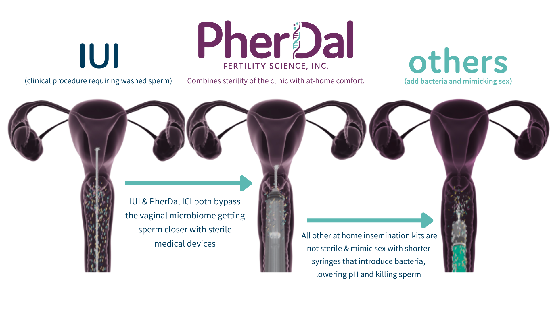 A Safe and Clean Alternative to a Lube Launcher for Conception ...